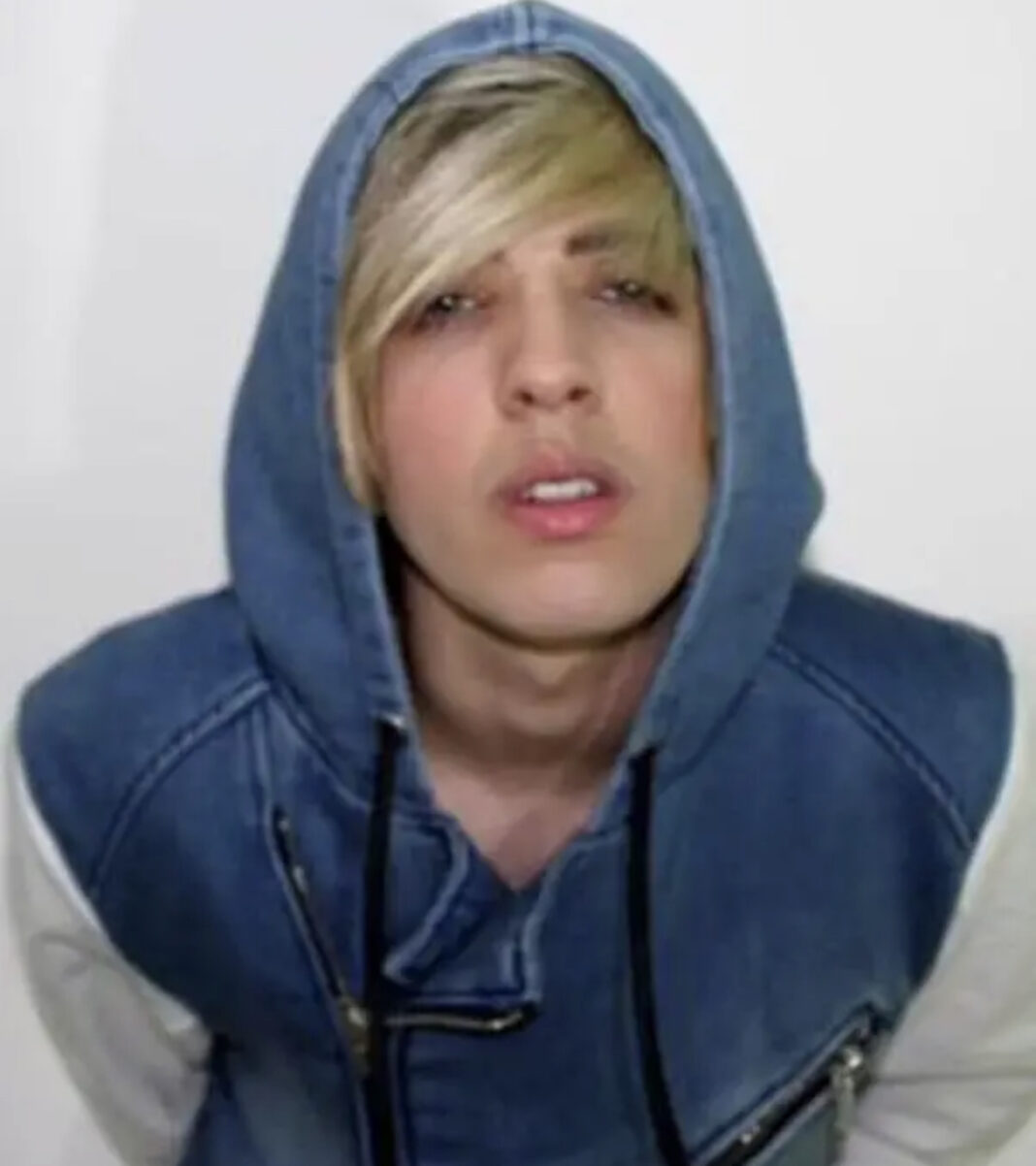 Von Colucci Wiki/Bio, Age, Before and After Surgery, Death, Family ...